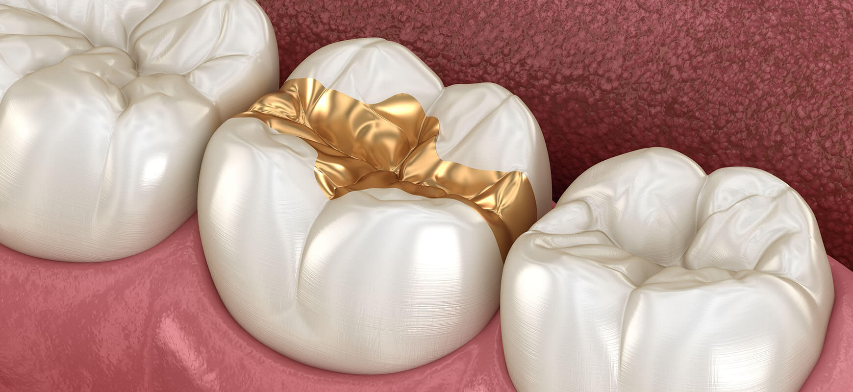 Diş Beyazlatma | Dünya Diş