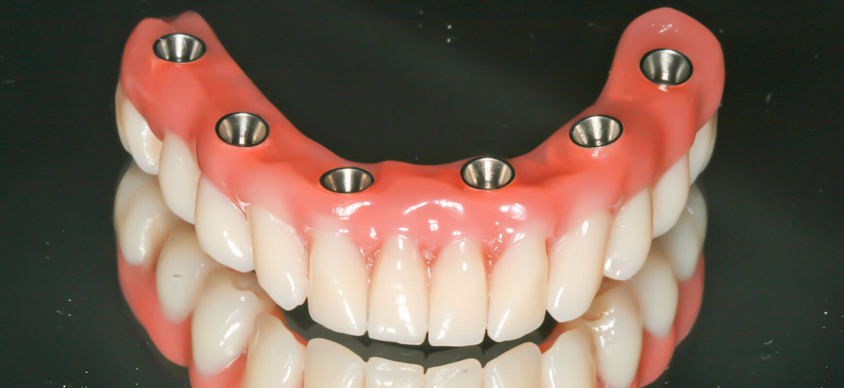 Tedaviler | Dünya Diş